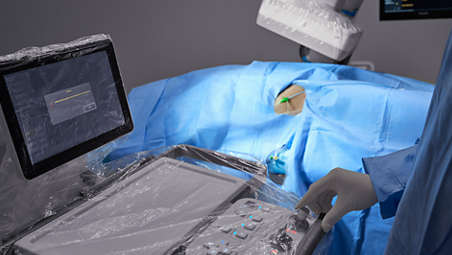 Philips Zenition 90 Motorized | Mediscala